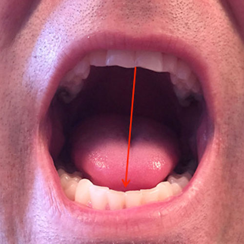 TMJ Evaluation | Examination, Imaging & more | TMJ Treatment