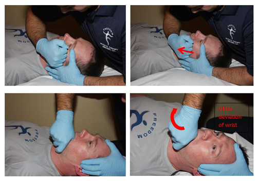 Tmj Treatment Temporomandibular Joint Dysfunction Treatment